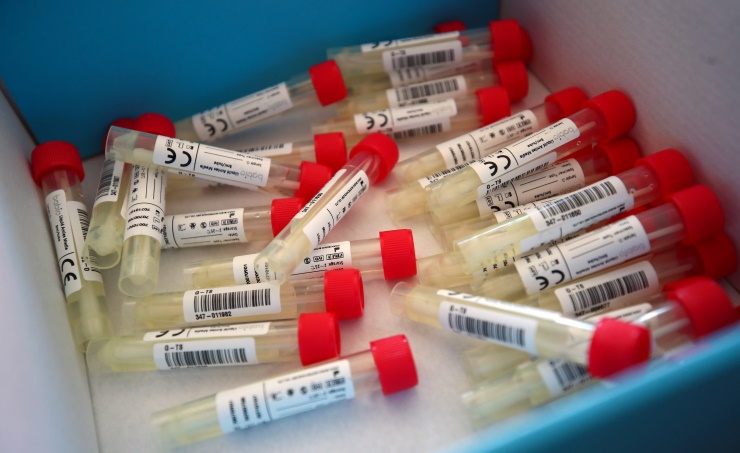 New global lab network will compare COVID-19 vaccines head-to-head