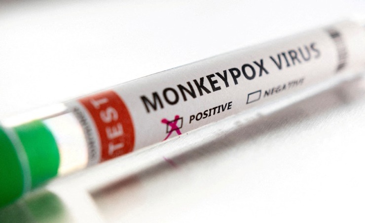China-based researchers develop rapid testing methods for monkeypox virus